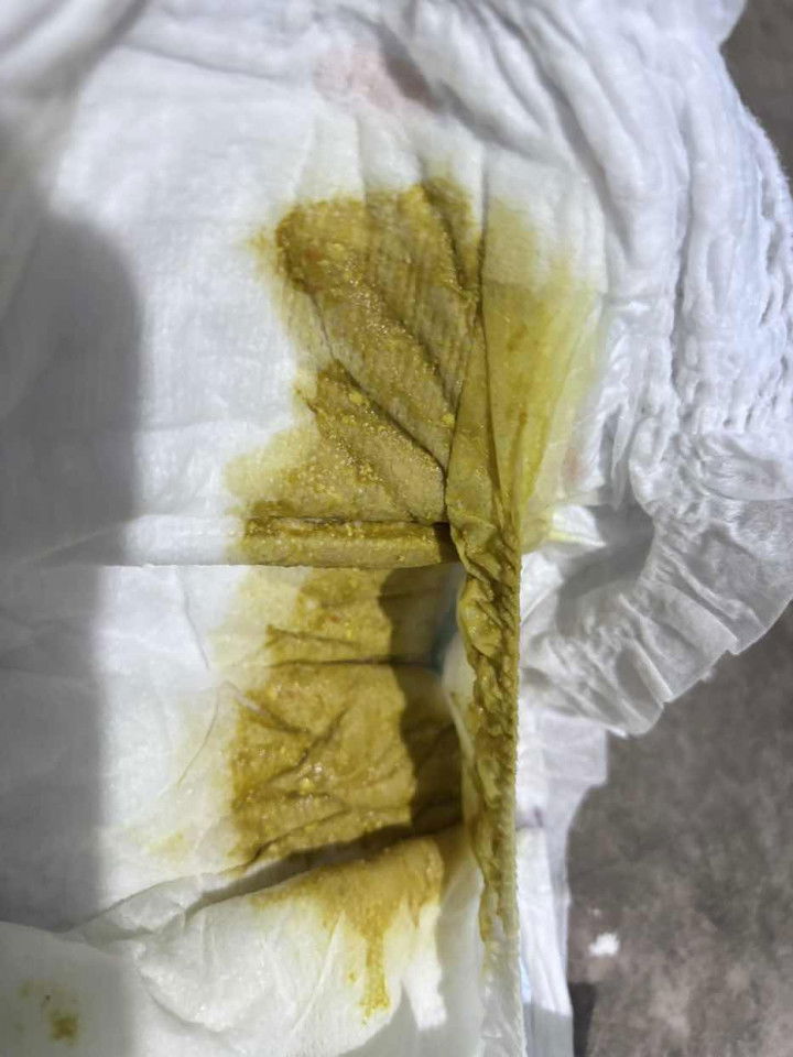 Watery poop Hi mommies, is this normal? Watery ang poop ni b