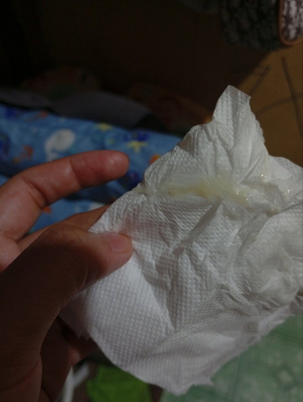 Mucus plug Hello mga mami pasintabi po may mucus plug nang