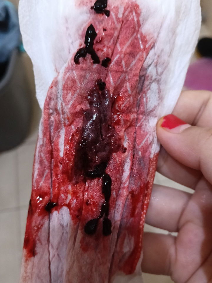 Is it blood clot or some tissue? Im on my third day period.