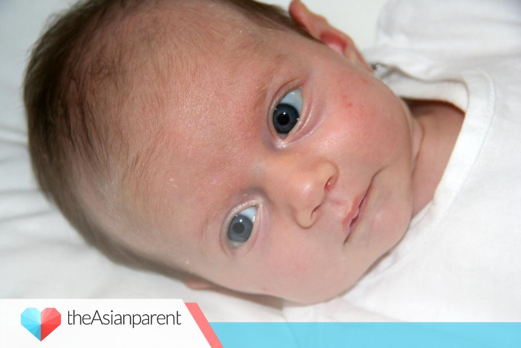 Swollen Head In Newborn Babies Aren't Always Risky!