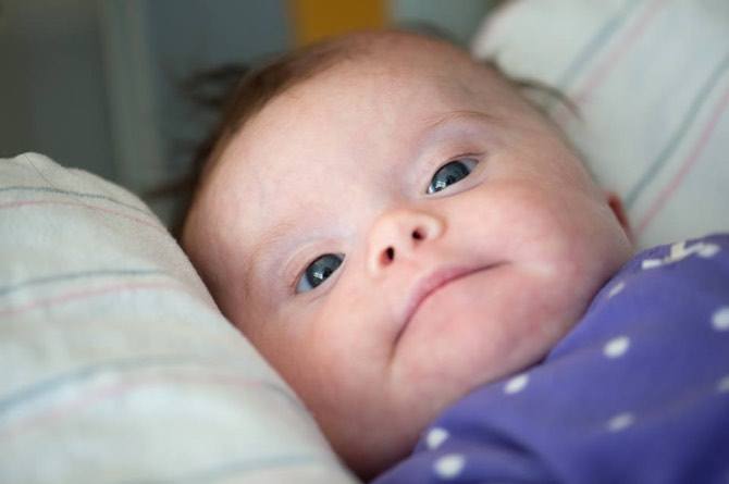 Baby with inoperable brain tumor should have died but...