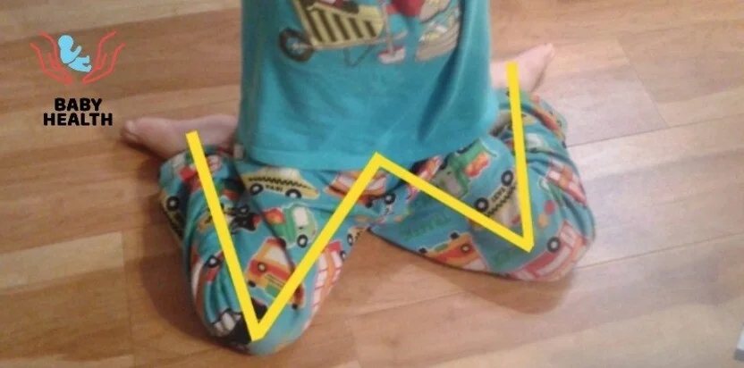 If Your Child is Sitting in The “W” Position, Stop Him Right Now!