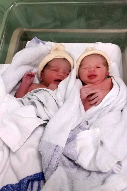 Twins Born with Different Skin Tones Draws Fascination of Many