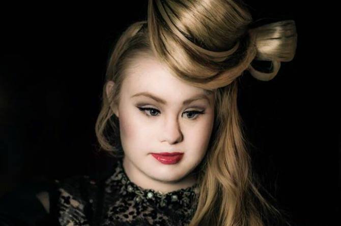 The World's First Model with Down Syndrome Elegantly Breaking Barriers