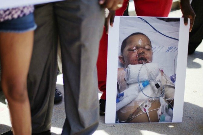 Flash grenade wounds toddler in a botched drug raid