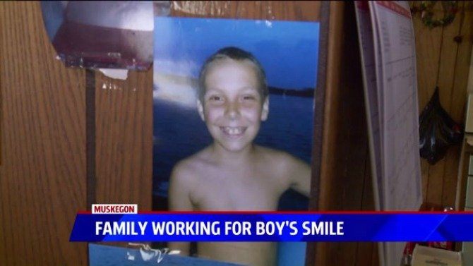 Boy With Rare Teeth Condition Stops Smiling After He Was Bullied