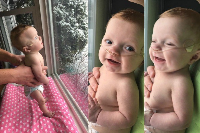 Miracle Baby's Reaction To Seeing Her First Snowfall Will Melt Your Heart
