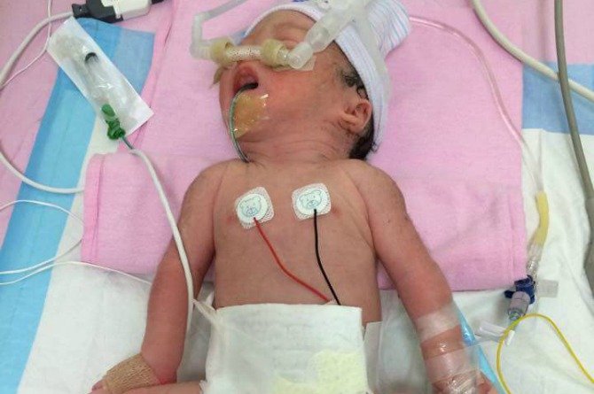 Birth Story: I Almost Died During Delivery - theAsianParent