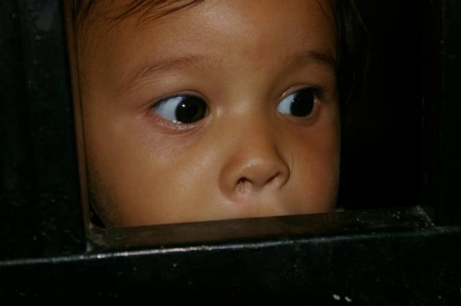 Dry Eyes In Kids: What Causes It, And How You Can Prevent It