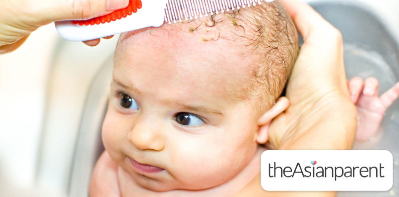 Cradle Cap O Infantile Seborrheic Dermatitis: Mga Importanteng Kaalaman