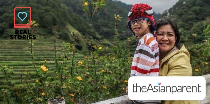 Ano Ang Down Syndrome: Mga Bagay Na Dapat Mong Malaman