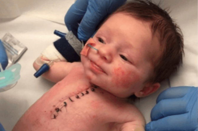 Newborn Heart Surgery: 4-Week-Old Baby Undergoes Open Heart Surgery