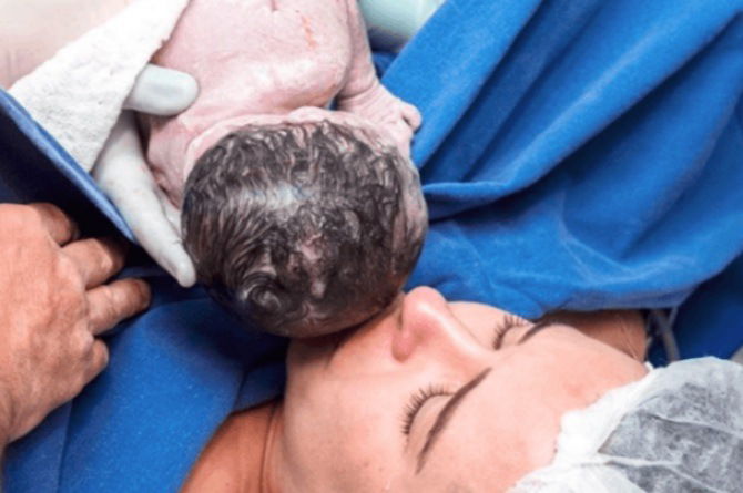 Newborn Stroke Impacts Brain: Know The Truth Behind This