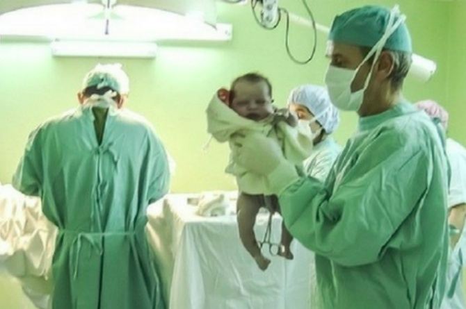 Birth Interventions Can Cause Long-Term Health Complications For Babies