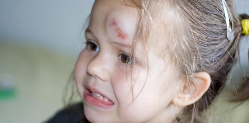 How Do I Know If Kid Has Concussion Symptoms And Treatment