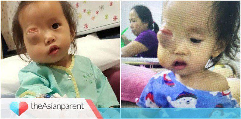 Sarcoma In Children – Symptoms And Treatment For Rhabdomyosarcoma