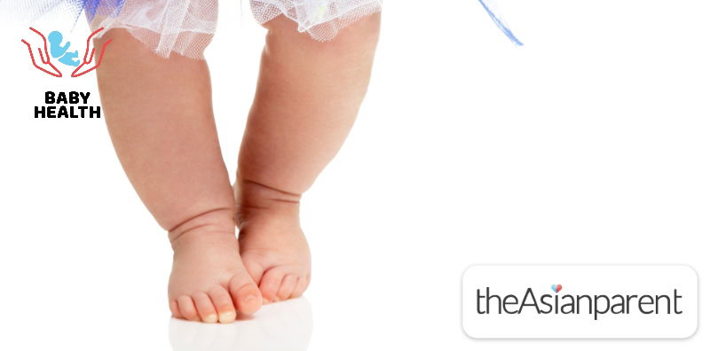 Sakang Na Paa Sa Babies: Paano Ito Magagamot O Maiiwasan