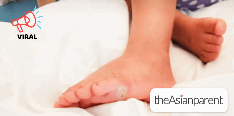 Paltos Sa Paa: Kung Bakit Hindi Dapat Balewalain Kung Meron Nito