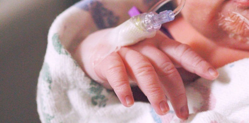 Infant Botulism Symptoms: Newborn Diagnosed With Infant Botulism