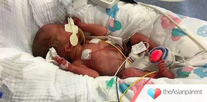 Butas sa puso ng sanggol, posible pa bang magamot?