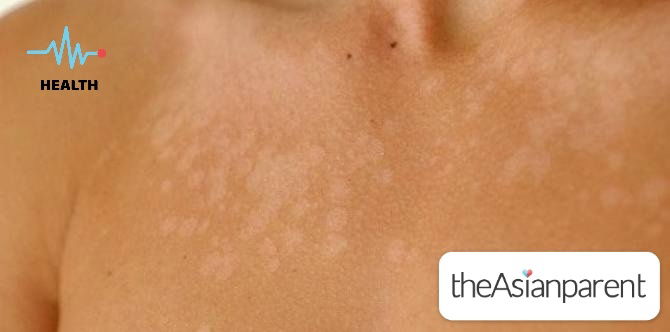 An An: Lunas at Gamot Na Makikita Sa Bahay | theAsianparent