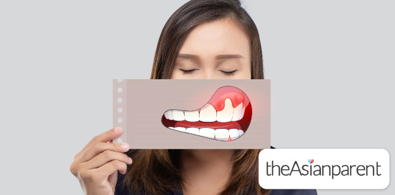 Nana Sa Gilagid At Ngipin: Sanhi, Sintomas At Lunas