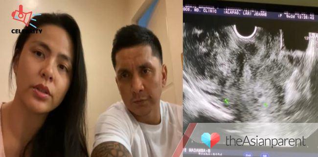 LJ Moreno And Jimmy Alapag Talks About Losing Their 4th Baby