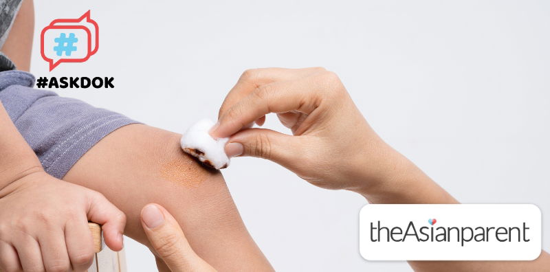 First Aid Para Sa Sugat? Ito Ang Sagot At Payo Ng Isang Doktor