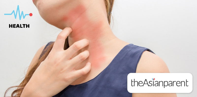 Allergy Sa Balat: 8 Irritants Na Maaaring Sanhi Ng Allergy