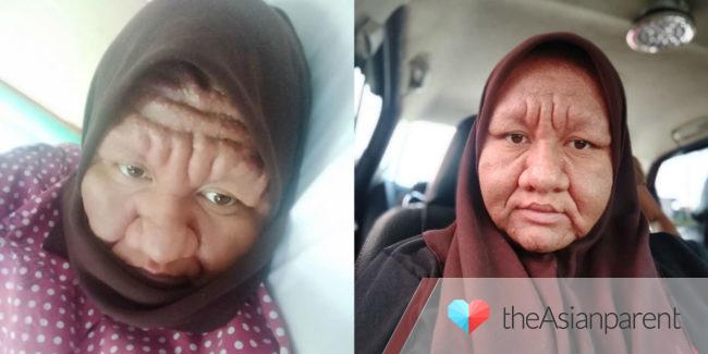 Pagbabago Sa Katawan Ng Buntis, Pinatunayan Ng Babaeng Ito Na Totoo!