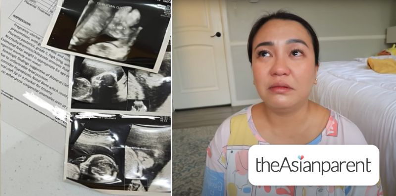 Anne Clutz Emosyonal Sa Natuklasan Ng Doktor Sa Kaniyang Baby