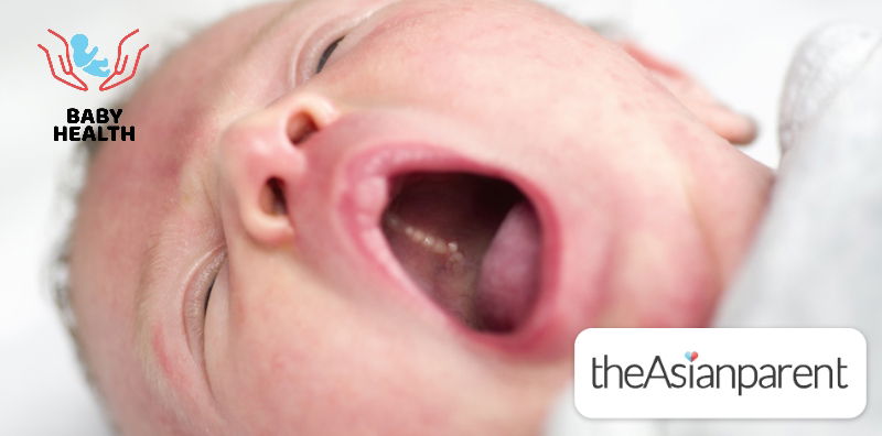 Epstein pearls in infants: what causes and how to treat?