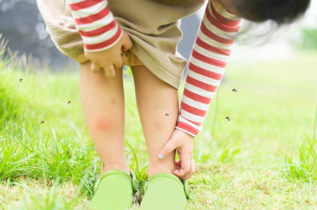 Types Of Bug Bites Chart: Precautions Parents Should Know About