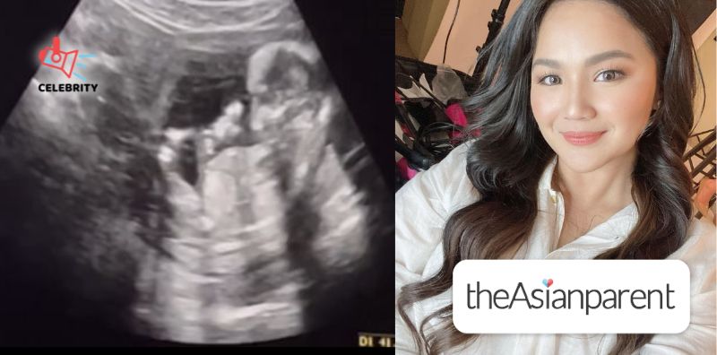 Ynna Asistio Masayang Inanunsyo Na Siya Ay Pregnant!