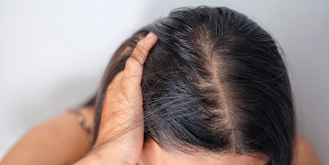 Tips Para sa Naglalagas na Buhok ng Bagong Panganak na Ina