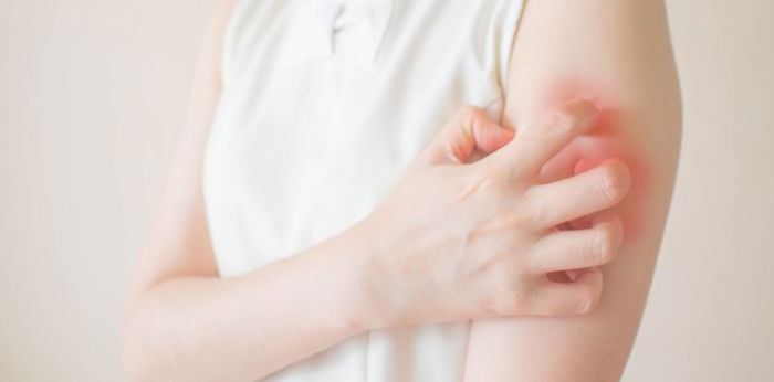 STSS Bacterial Infection O Toxic Shock Syndrome Sa Pilipinas