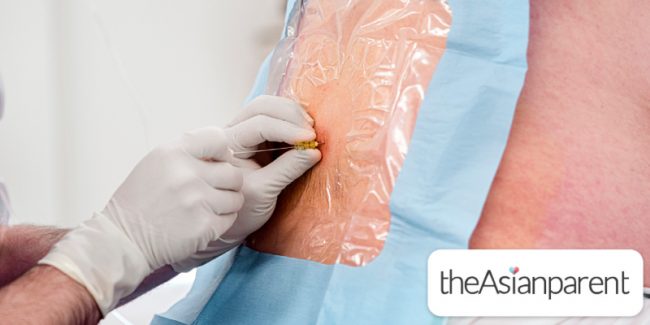 Spinal Block for Labor Pain: Benefits, Risks, and What to Expect