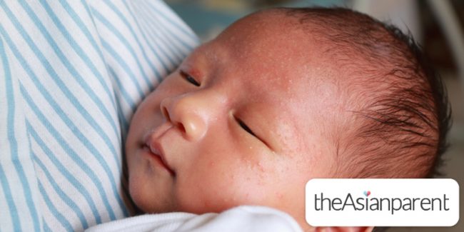 Baby's Skin Rashes: Possible Causes and Home Remedies to Try