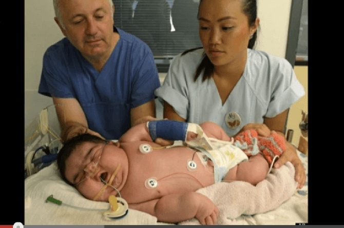 Jasleen Heaviest Baby Germanys Largest Ever Baby Born Germany's