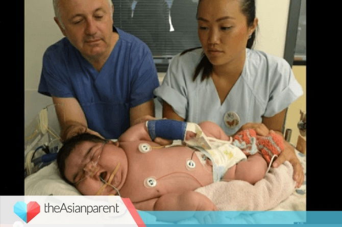 Jasleen Heaviest Baby Germanys Largest Ever Baby Born Jasleen The