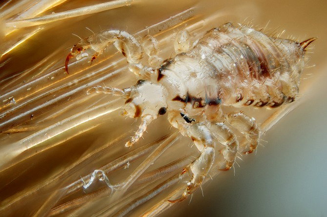 A Medicine-Resistant Super Lice Is Plaguing The United States