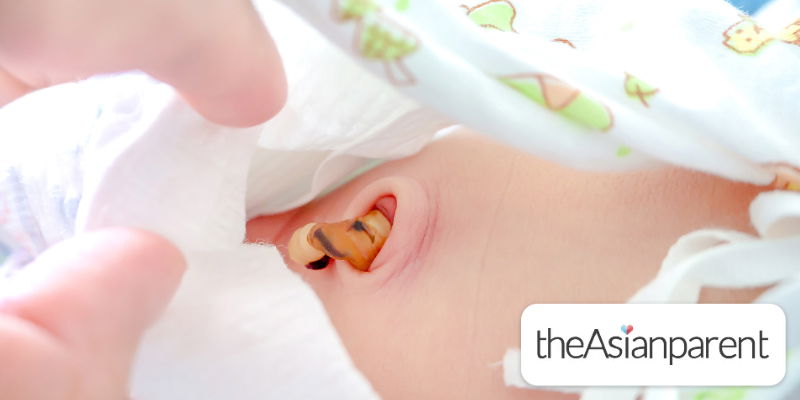 Newborn Umbilical Stump Care The Basics Explained