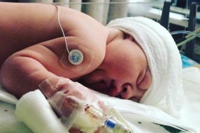 Baby Born Without Back of Skull Defies Odds And Survives