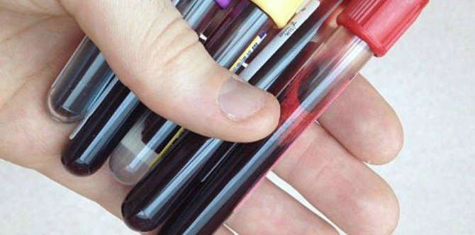 Rarest Blood Type On Earth Needed For Toddler With Cancer