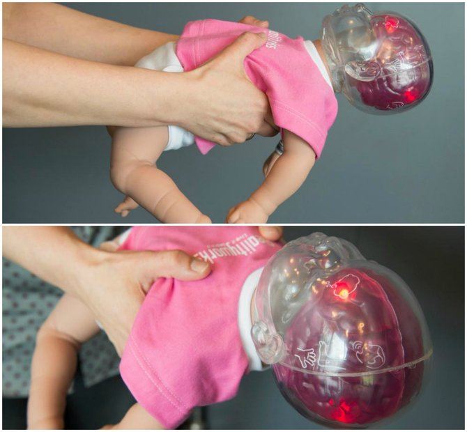 This Doll Shows The Horrifying Damage Caused By Shaking Your Baby
