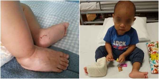 Juvenile Arthritis In Singapore: Mum Shares Her Son's Struggle