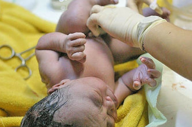 function of umbilical