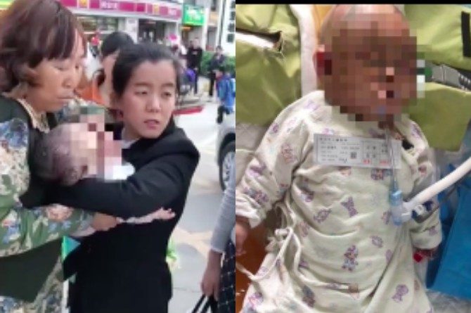 High-rise safety: Falling Apple hits baby, puts her in Coma