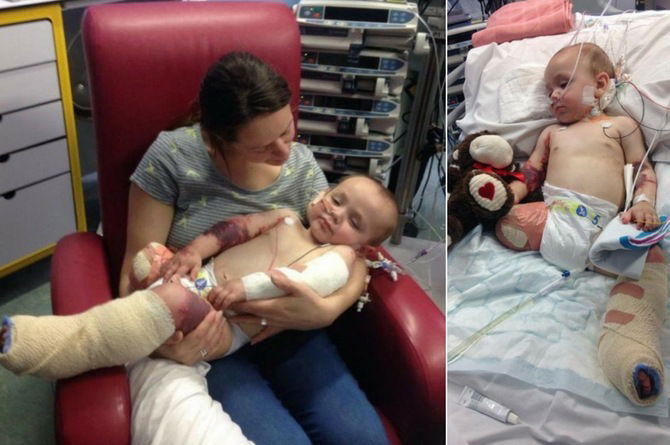 Septicemia Symptoms In Toddlers: All Parents Need To Know