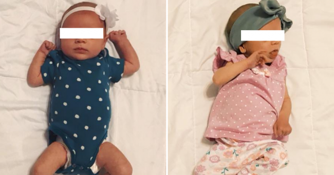 Tongue Tie Breastfeeding Issues Mum S Warning After Baby Loses Weight